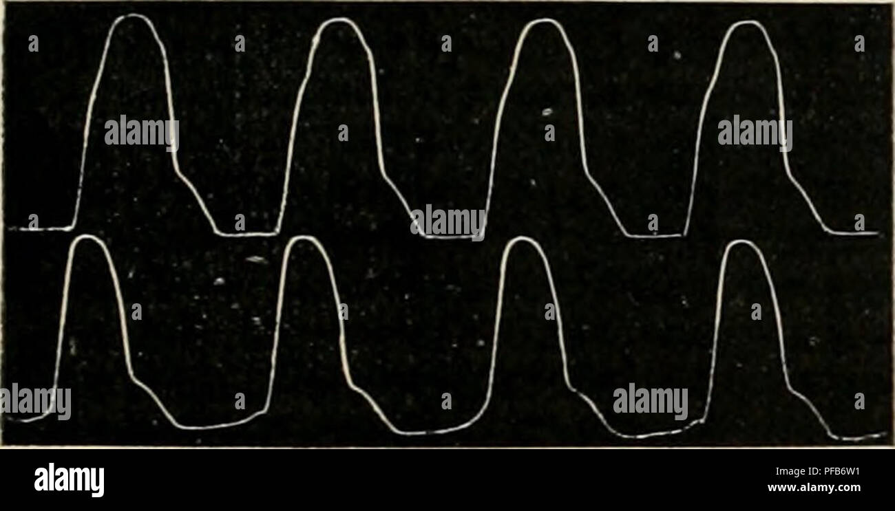 Muscle contractions hi-res stock photography and images - Alamy