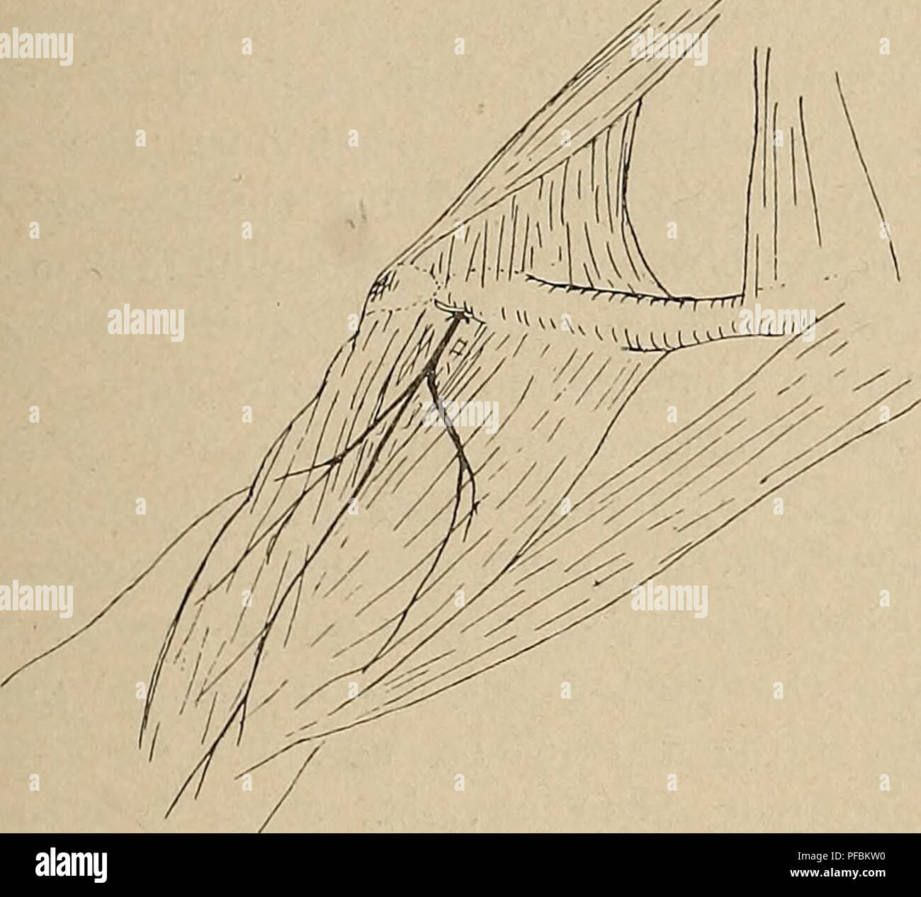 This illustration depicts the brachial plexus in primates, focusing on ...