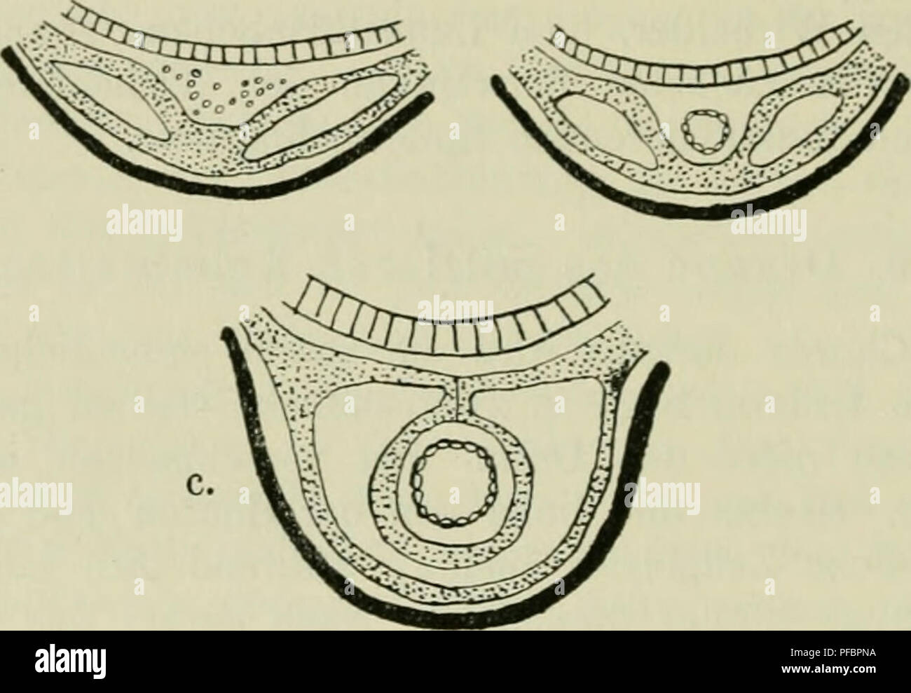 Mesenterium hi-res stock photography and images - Alamy