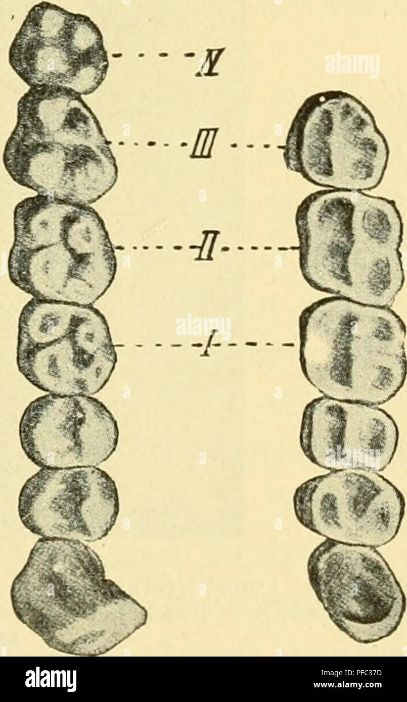 Zahnfleisch hi-res stock photography and images - Alamy
