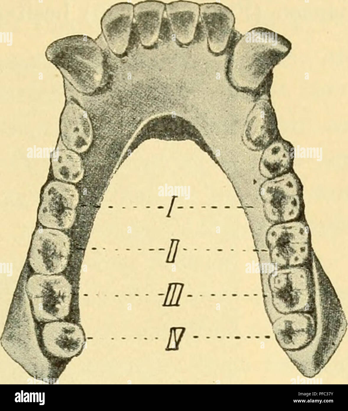 Zahnfleisch hi-res stock photography and images - Alamy