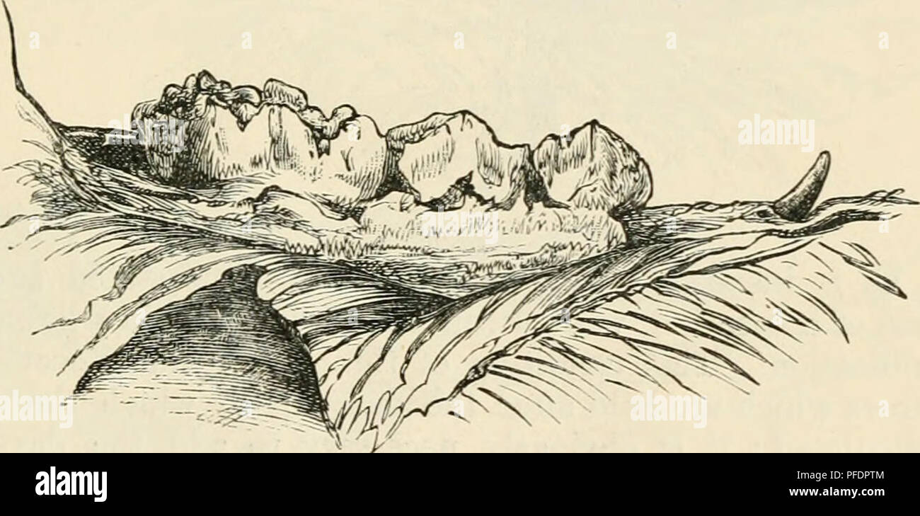Illustration showing the development of temporary and permanent teeth ...