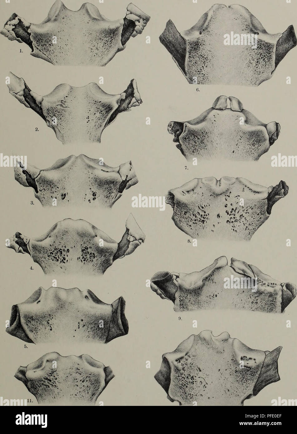 Manubrium Sterni High Resolution Stock Photography and Images - Alamy