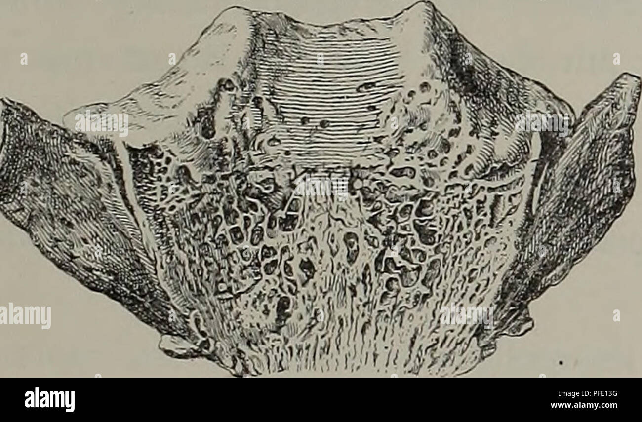This paper presents a study on the morphology of the manubrium sterni ...