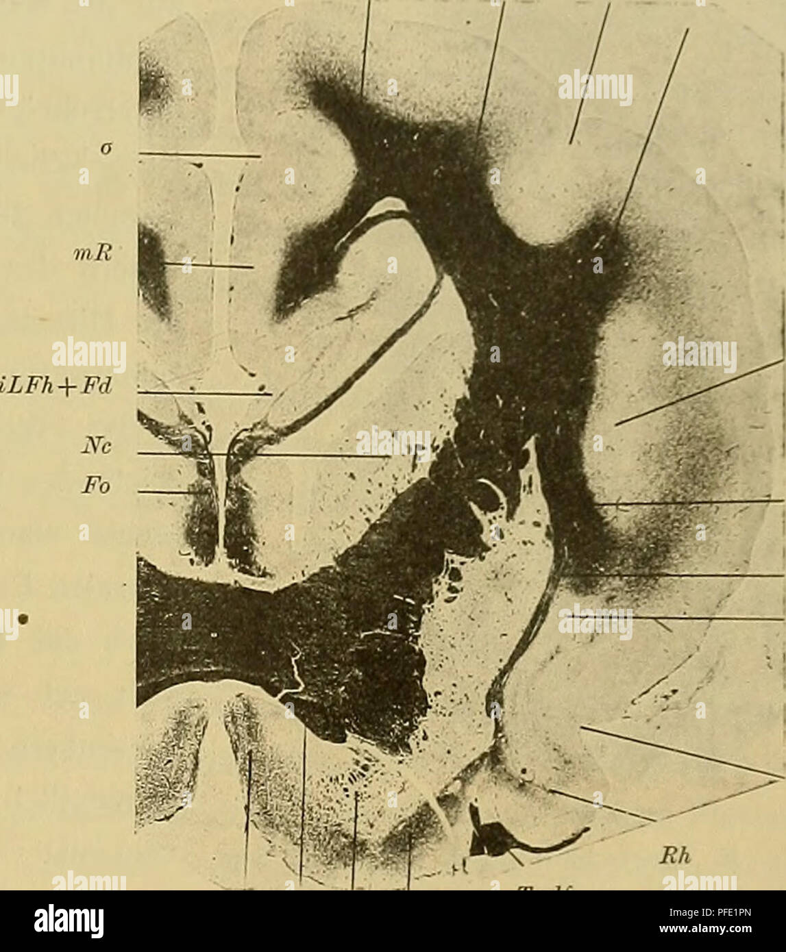 Capsula interna hi-res stock photography and images - Alamy