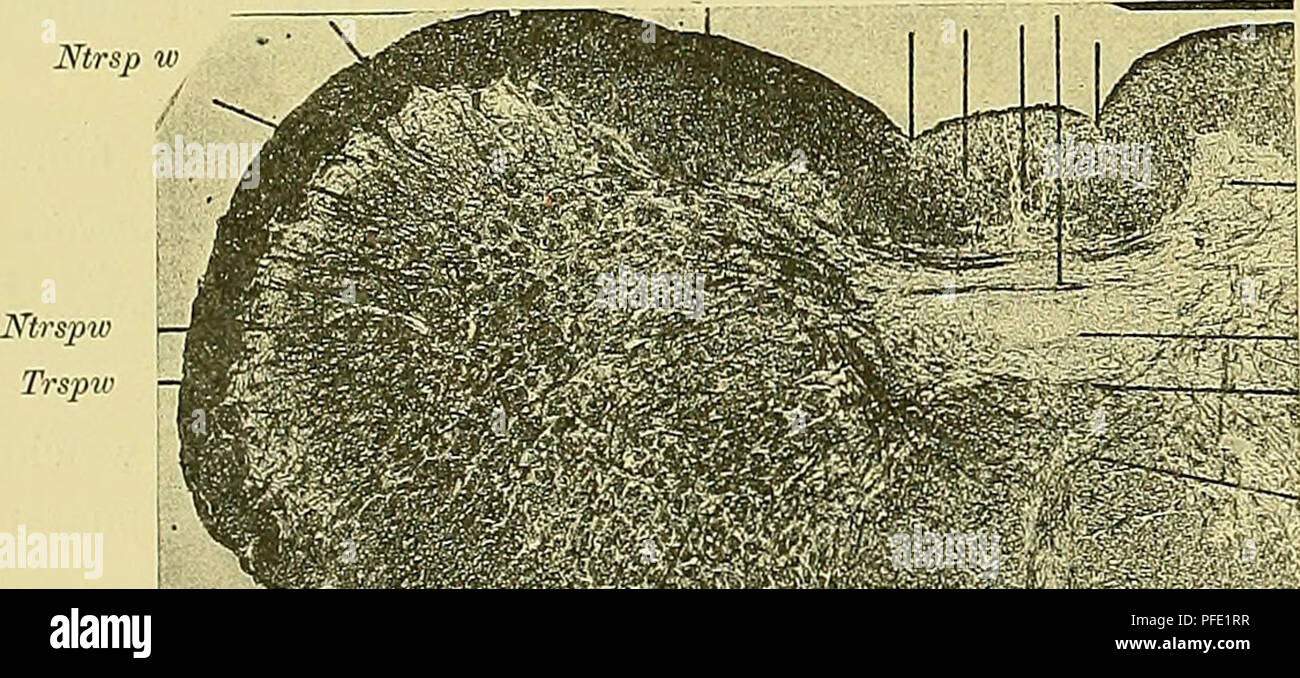 Dorsolaterale hi-res stock photography and images - Alamy