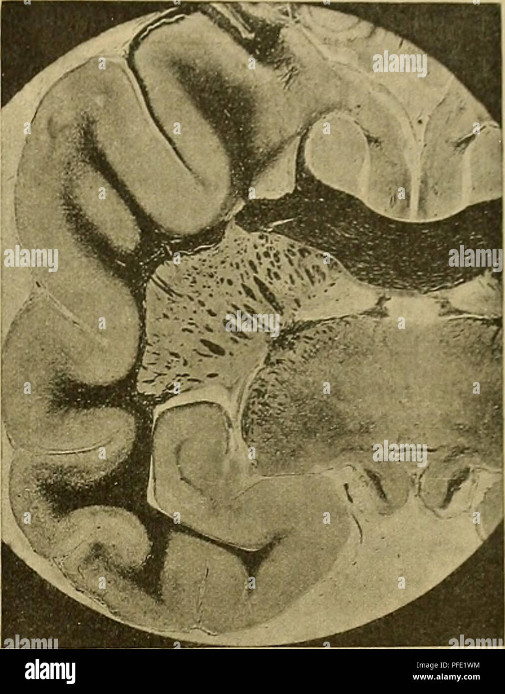 Umkreist hi-res stock photography and images - Alamy