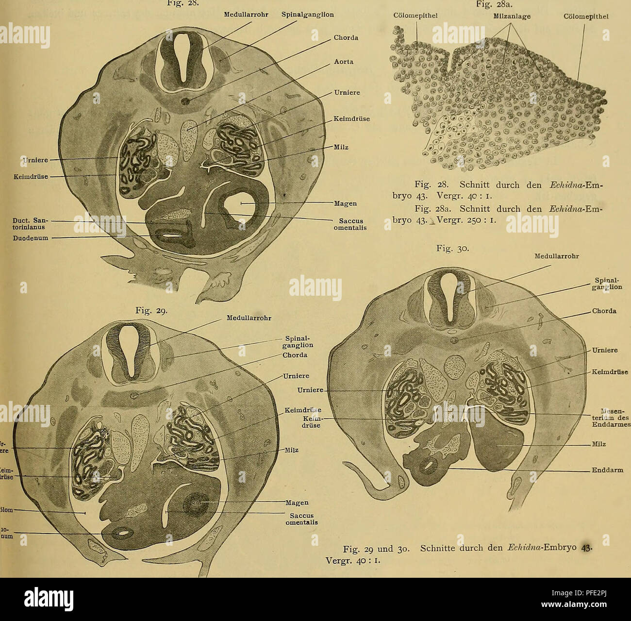 Choledochus hi-res stock photography and images - Alamy