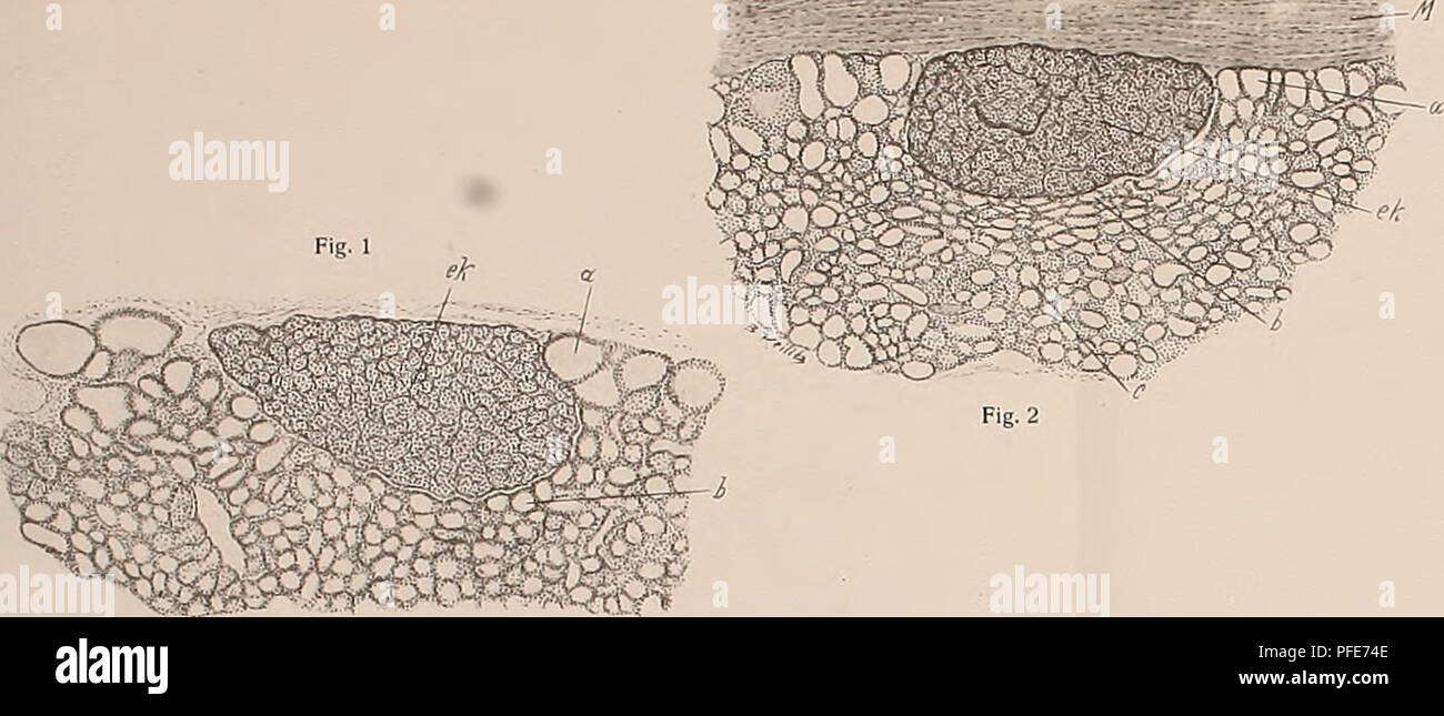 Rachitis hi-res stock photography and images - Alamy