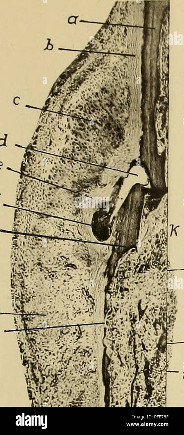 Rachitis hi-res stock photography and images - Alamy