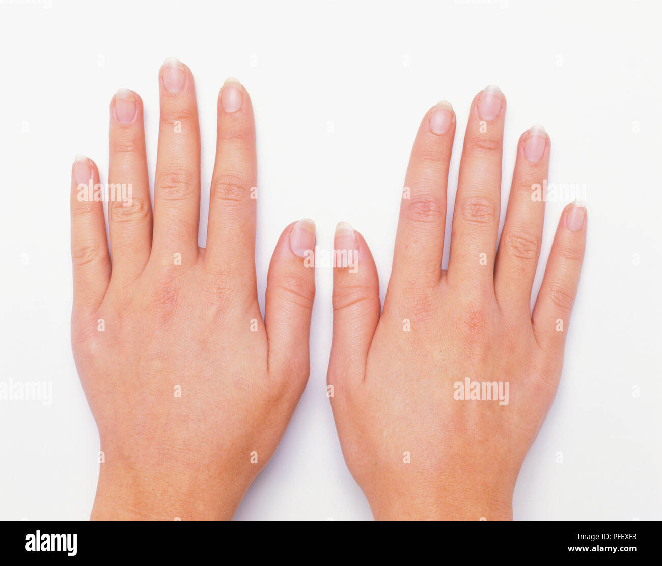 A woman's hands, back view Stock Photo - Alamy