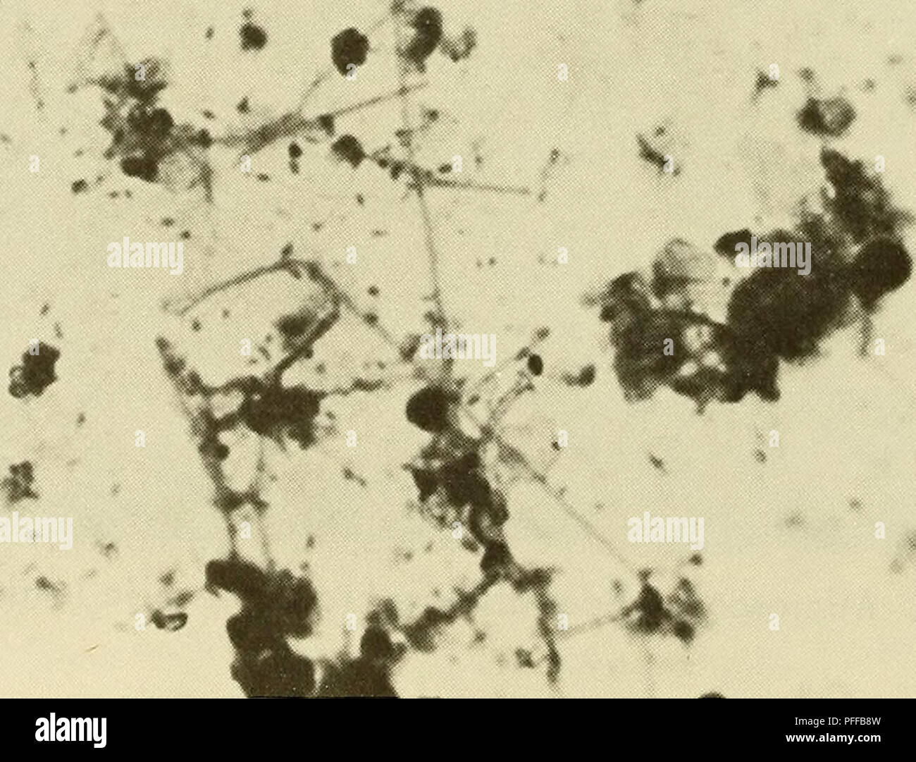This research explores the microbial degradation of materials in deep ...