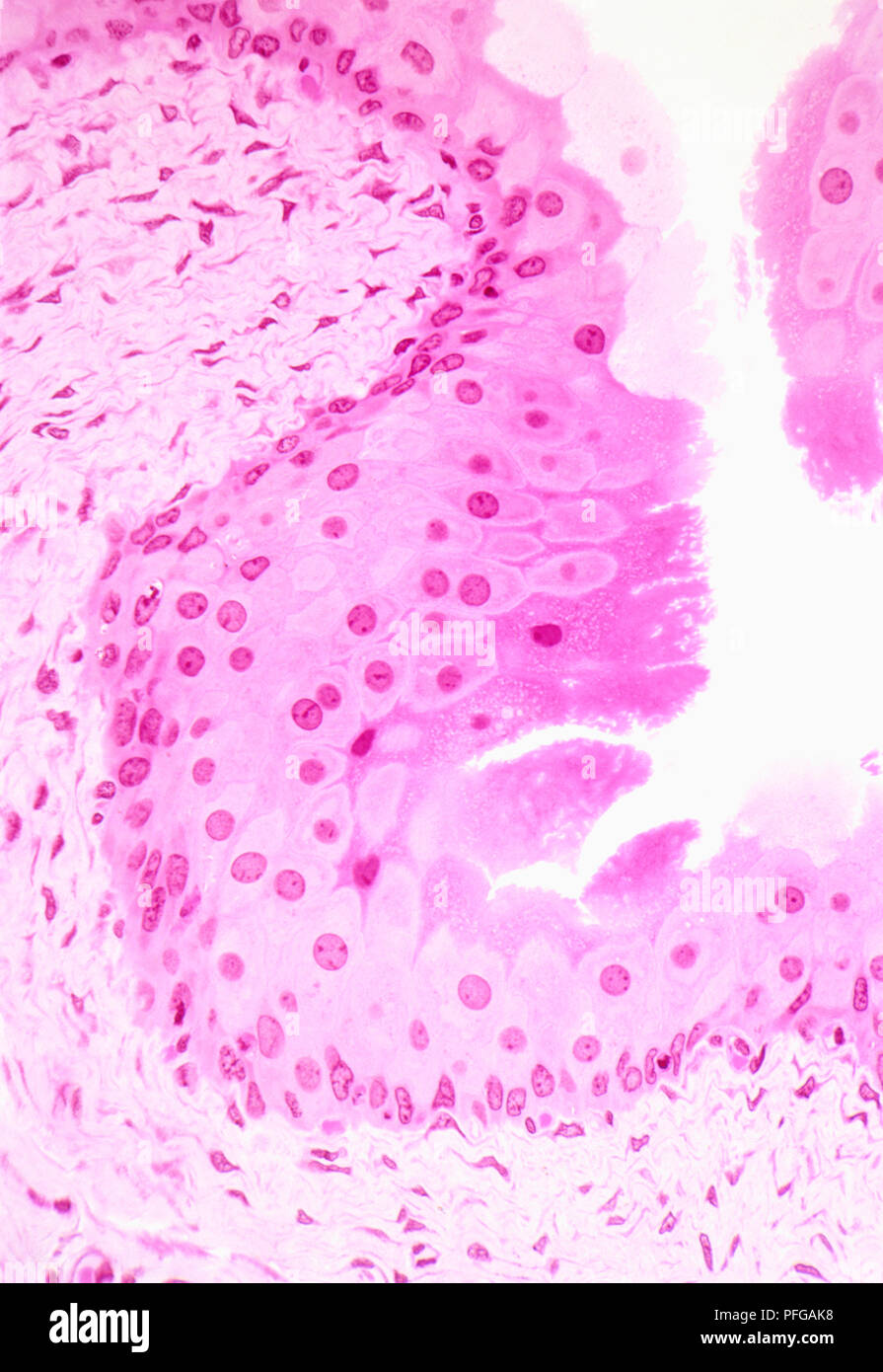 Sample of human bladder tissue seen through microscope, close-up Stock ...