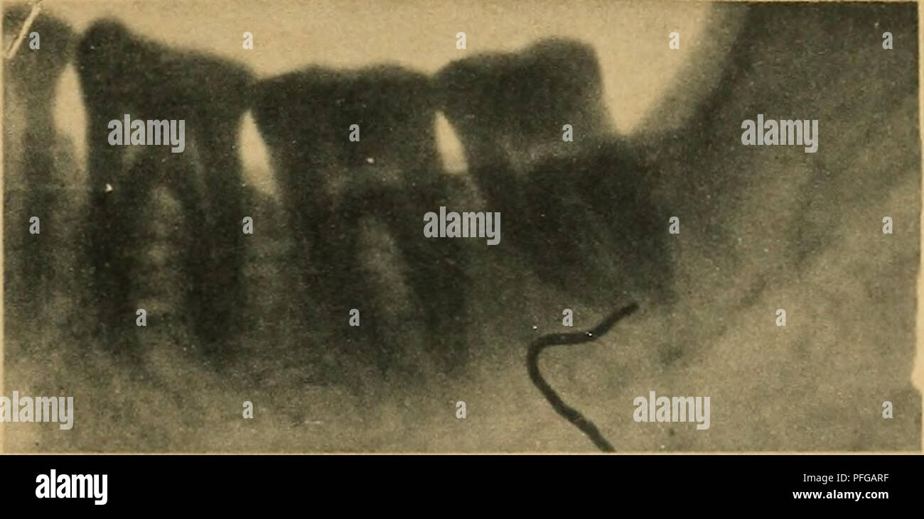 This comparative anatomical study by Paul Adloff explores the human and ...