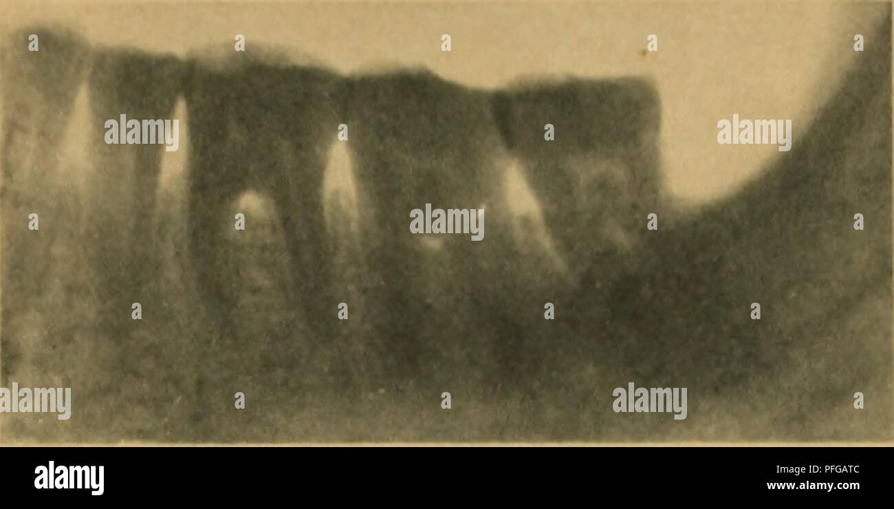 This comparative anatomical study examines the teeth of humans and ...