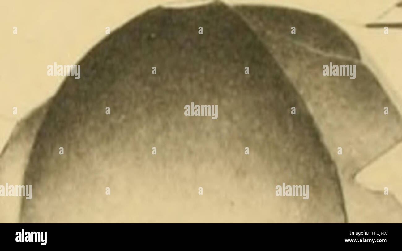 This illustration from Heinrich Prell's work on Protura shows the ...