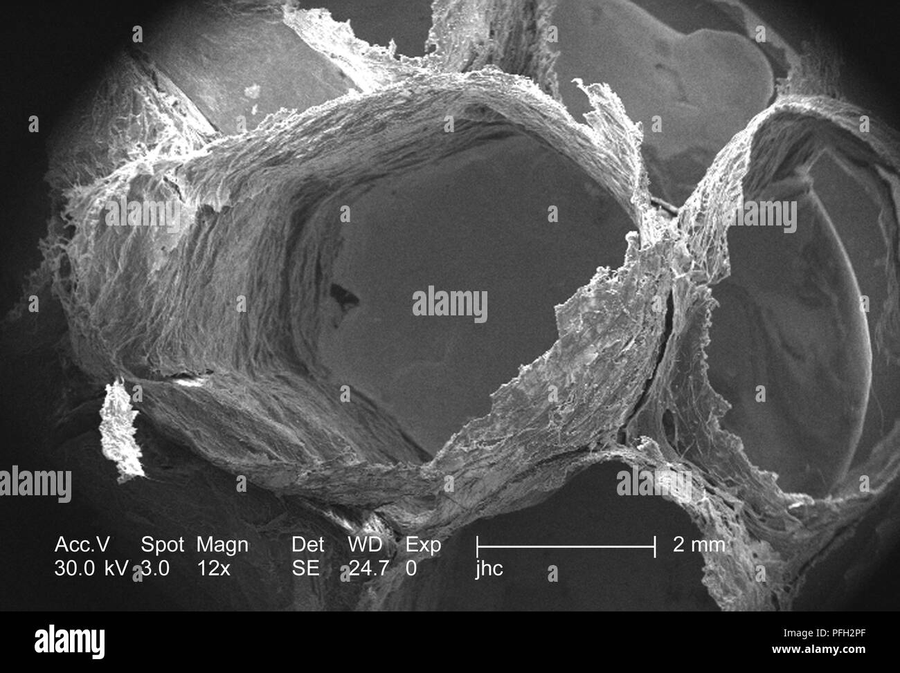 Microscopic wasps hi-res stock photography and images - Alamy
