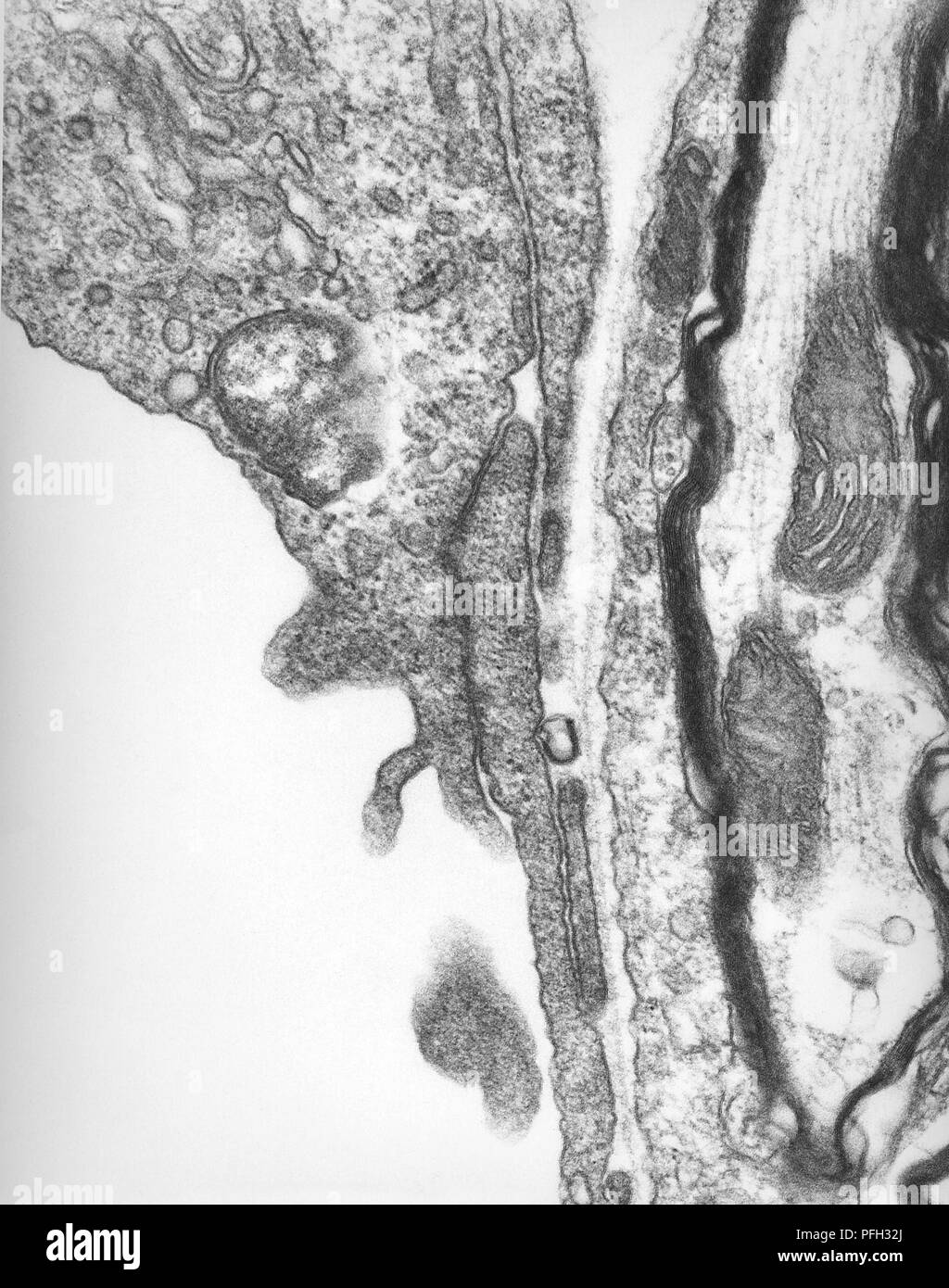 Brain capillary of a mouse experimentally infected intravenously with ...