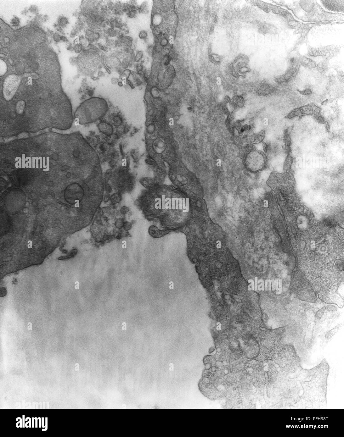 Peritoneal cavity hi-res stock photography and images - Alamy