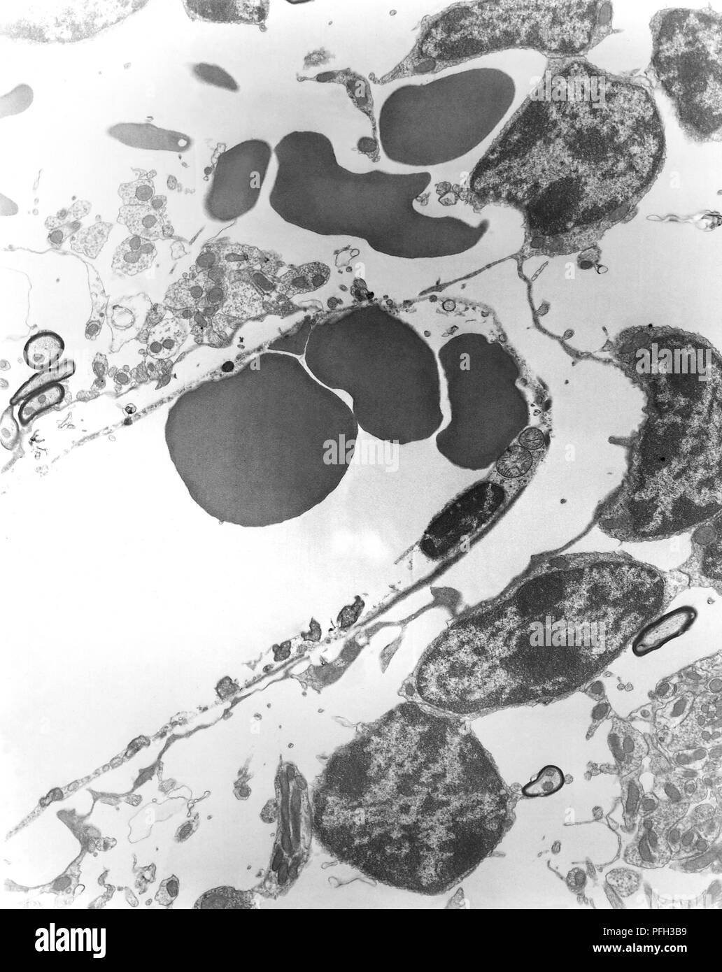 Brain capillary of a mouse experimentally infected intravenously with ...