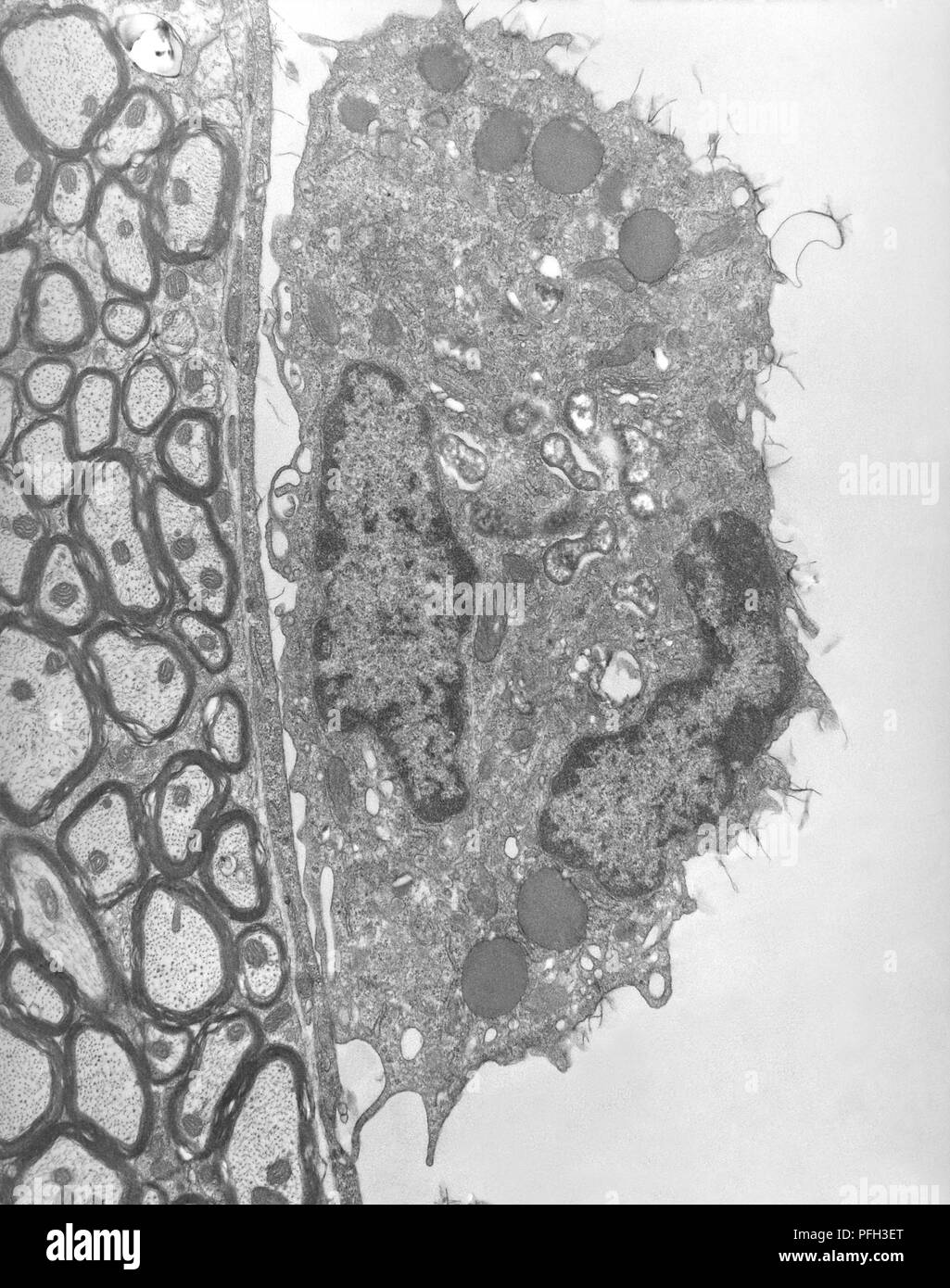 Brain capillary of a mouse experimentally infected intravenously with ...