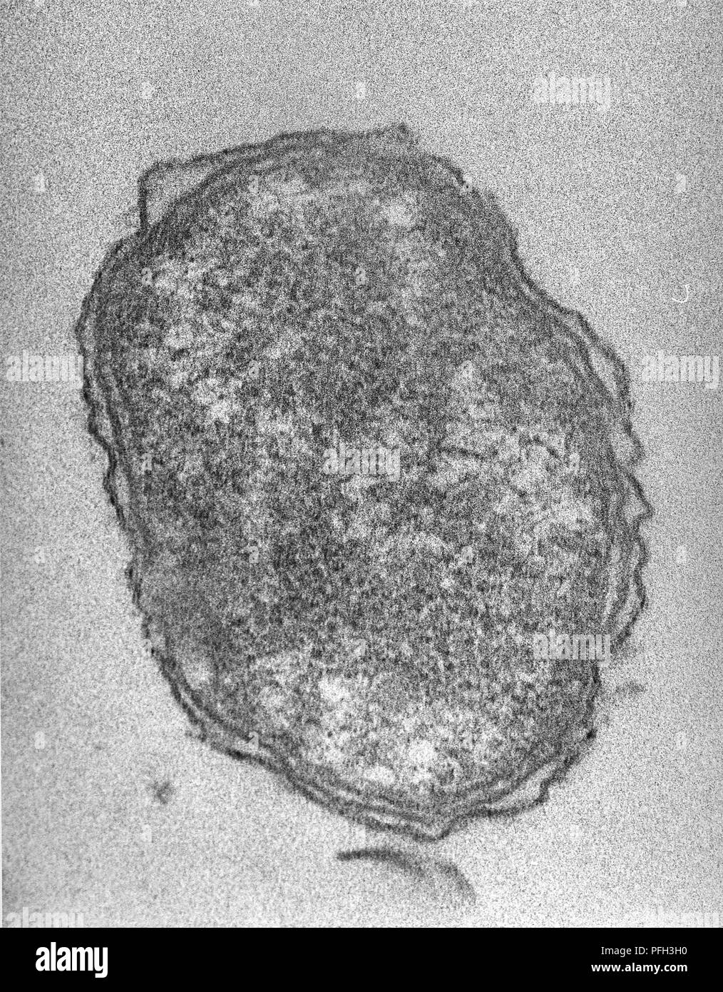 Rickettsia Rickettsii Microscope