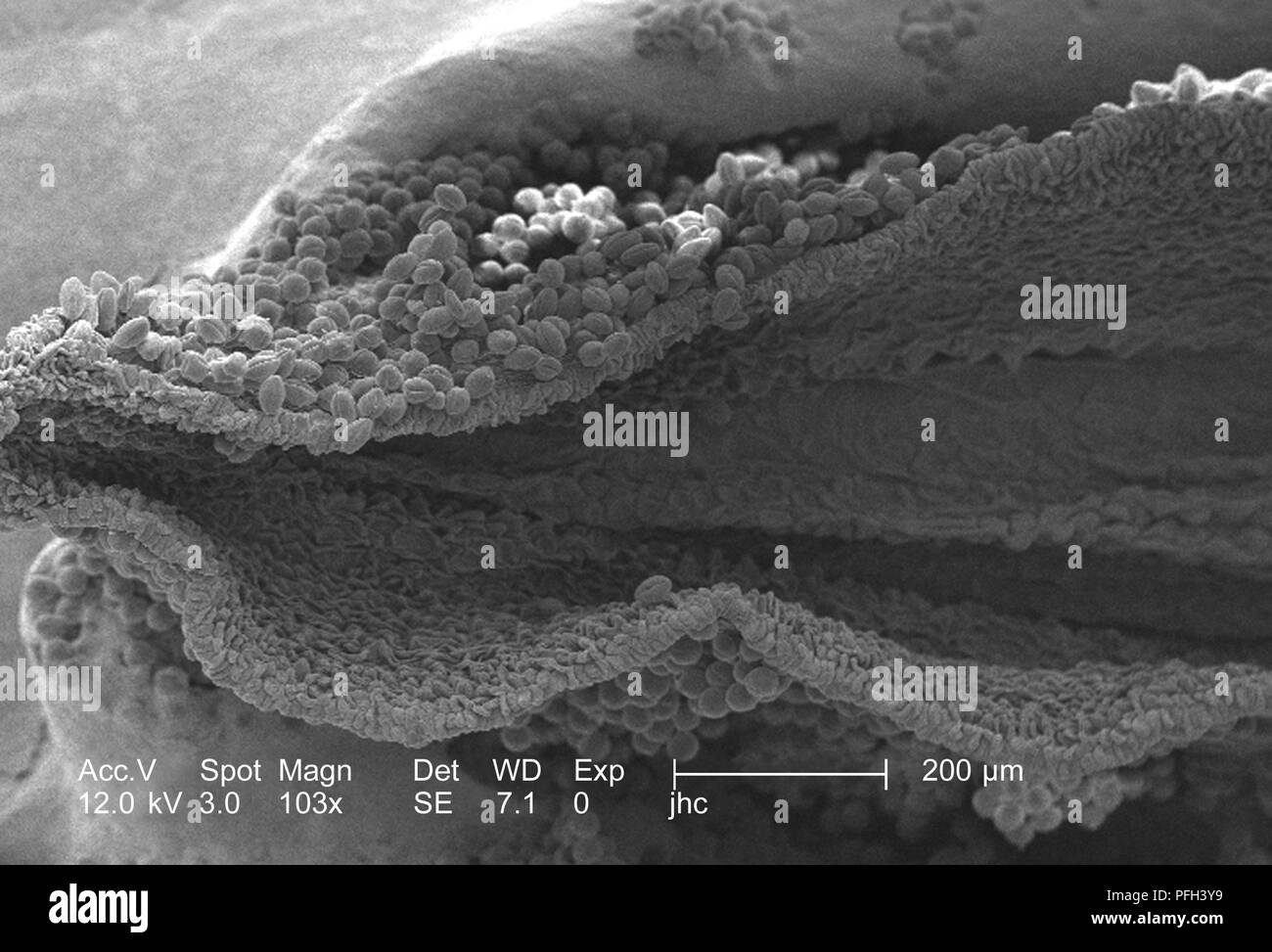Morphologic ultrastructure of pollen granules found on a yellow ...