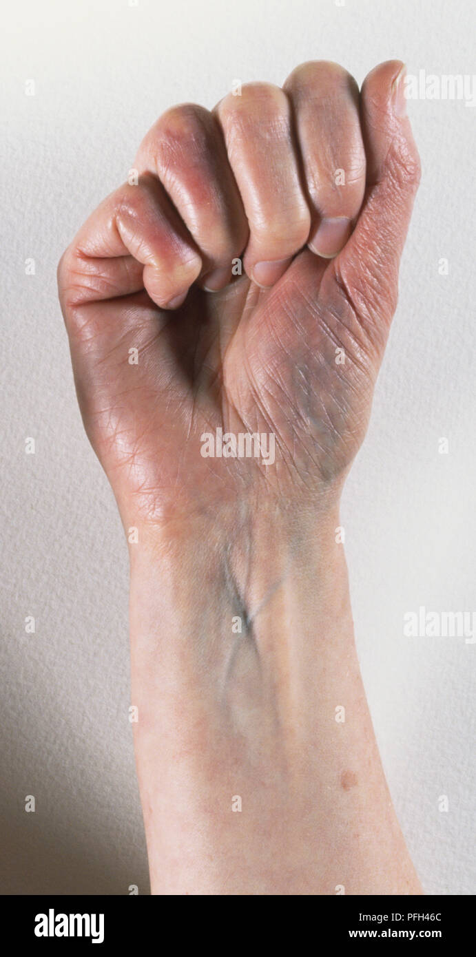 Clenched Fist Side View