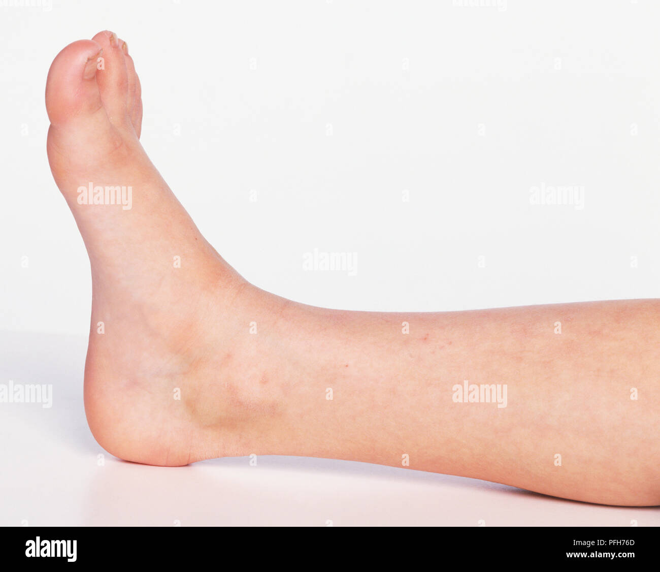 A child's foot and lower leg, side view Stock Photo - Alamy