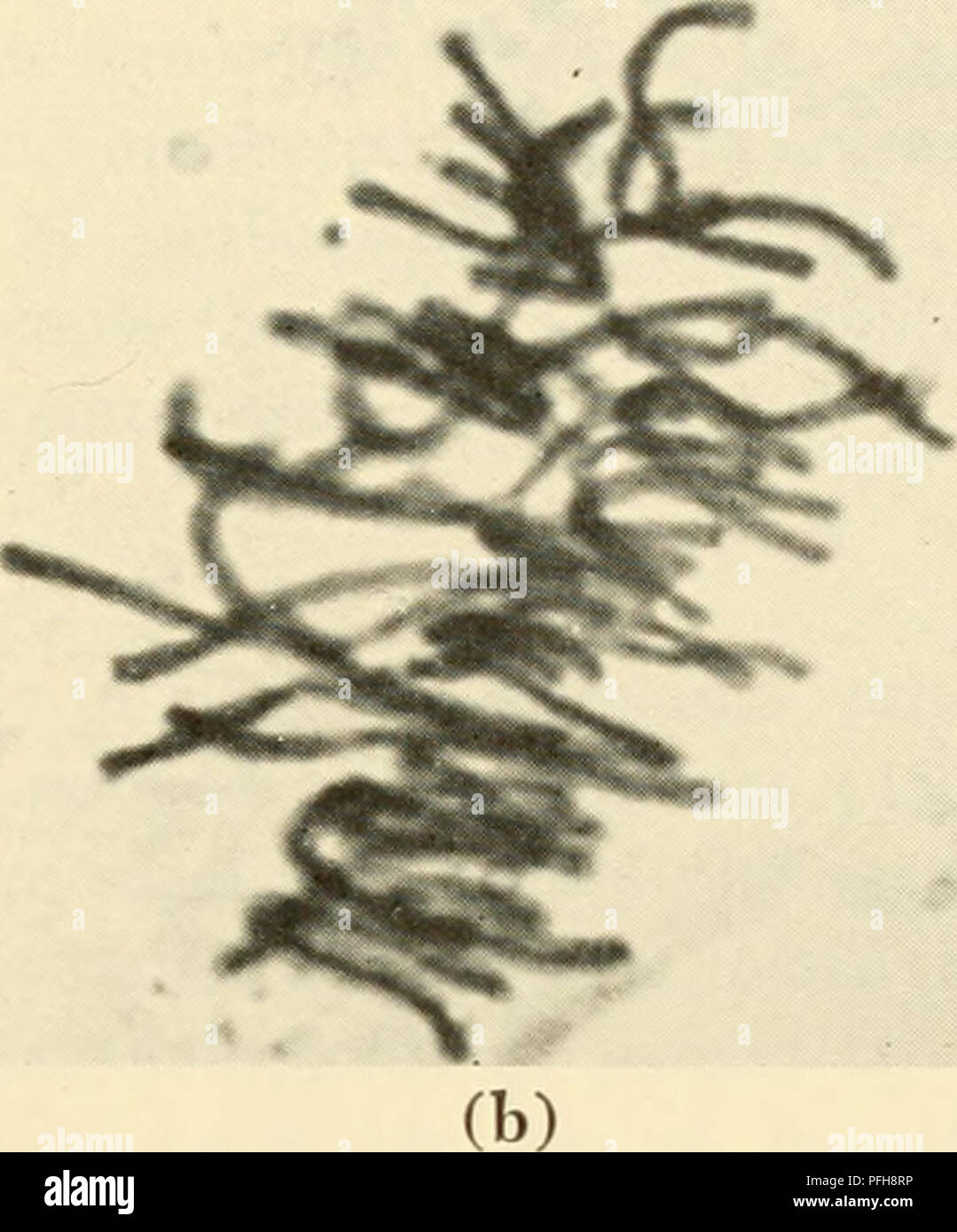 Metaphase hi-res stock photography and images - Alamy