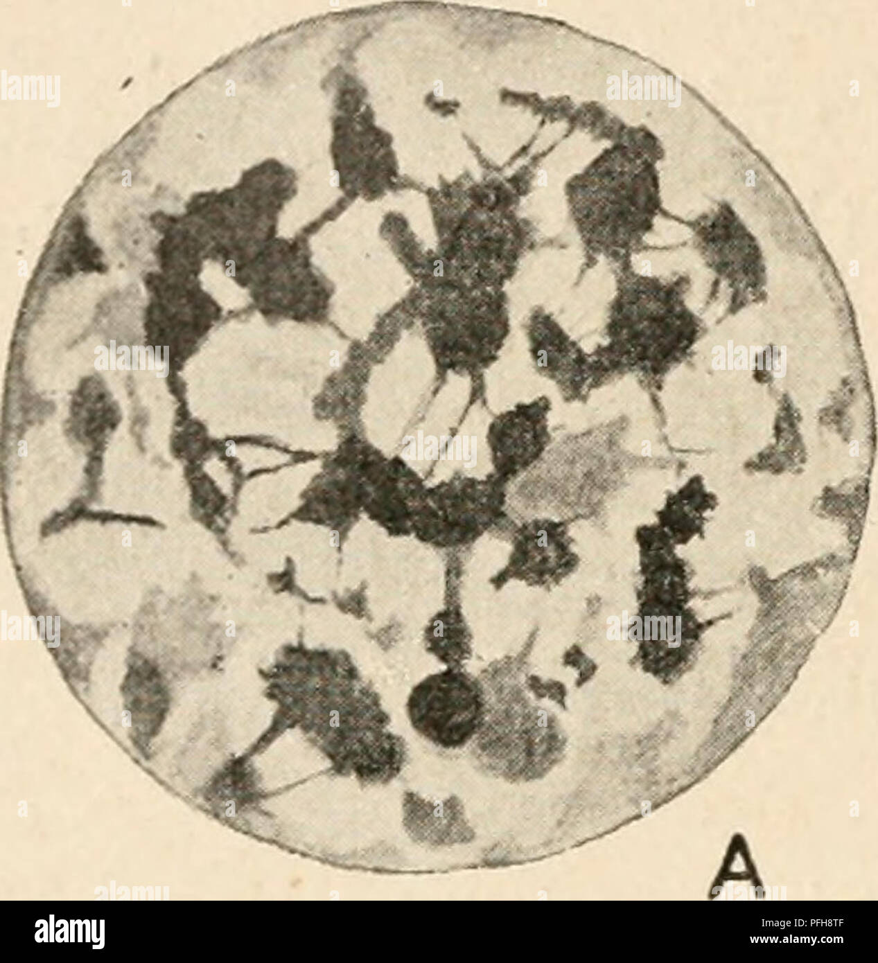 Tomopteris High Resolution Stock Photography and Images - Alamy