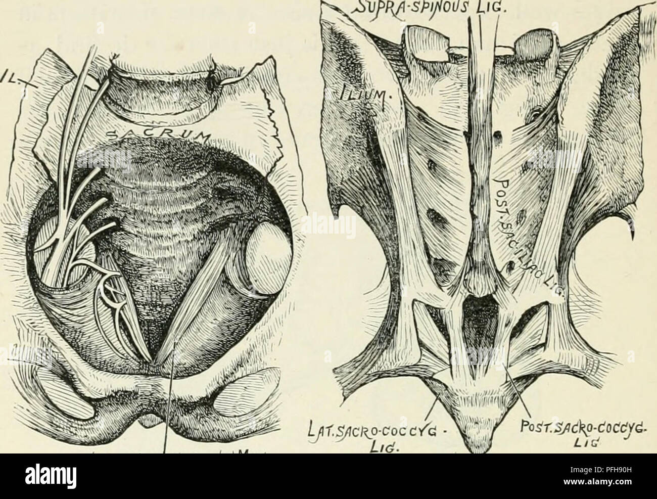 Human Tail Vestigial