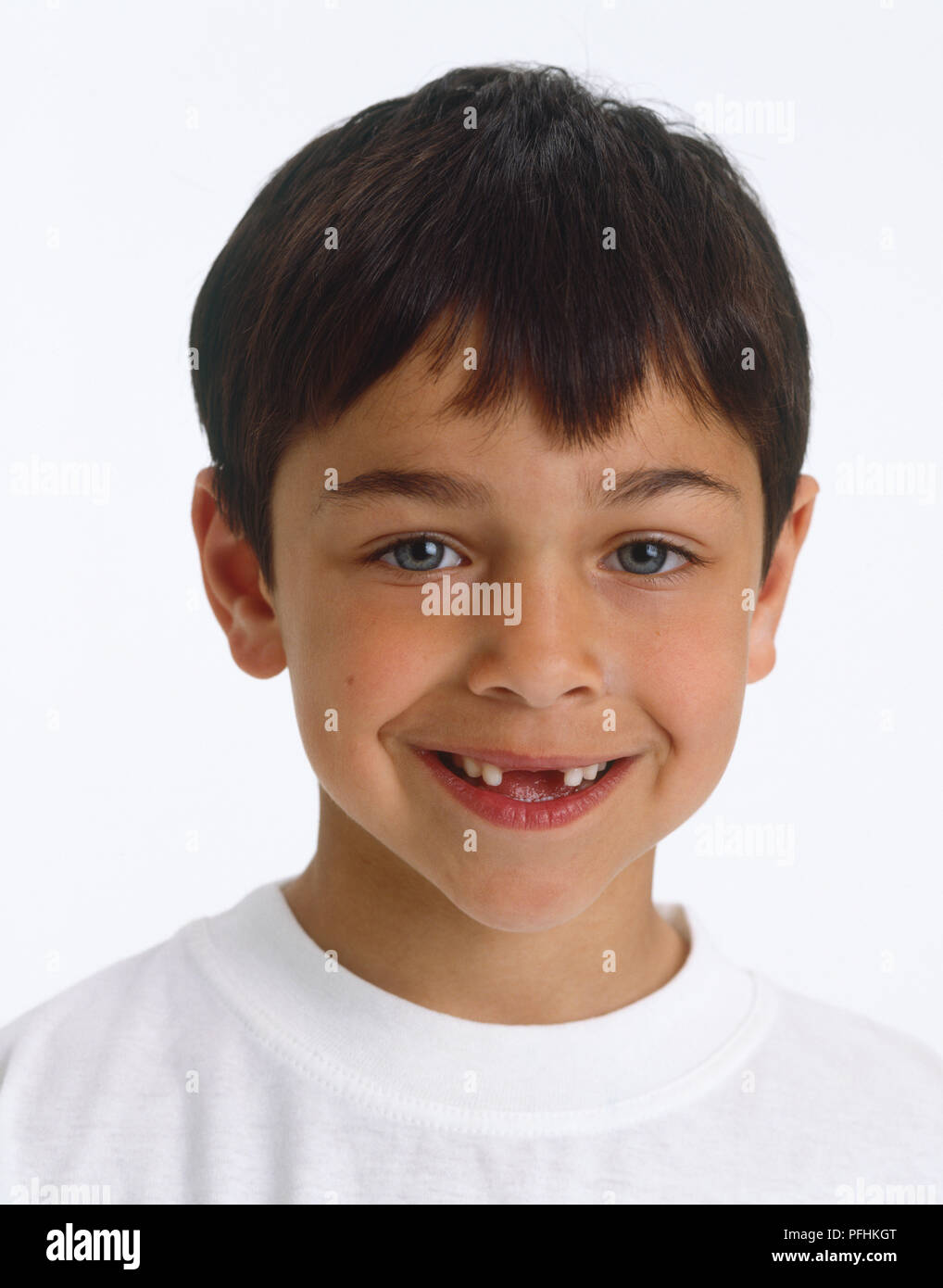 Boy with front teeth missing, front view Stock Photo - Alamy