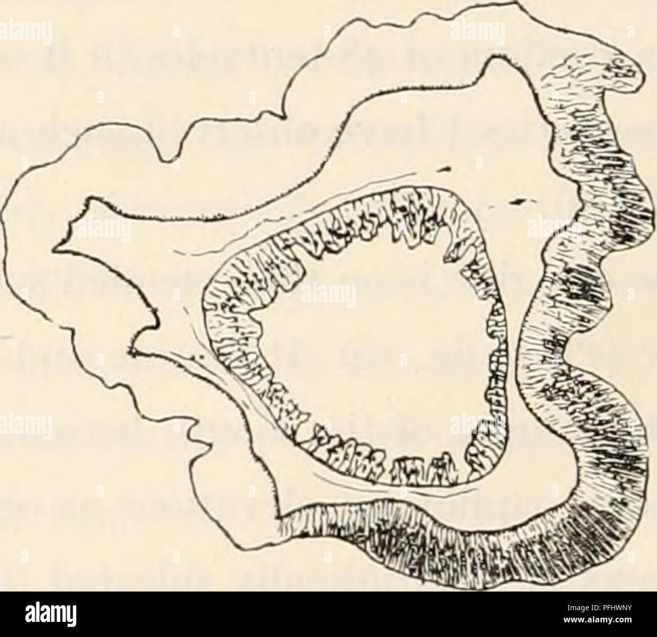 Distal section hi-res stock photography and images - Alamy