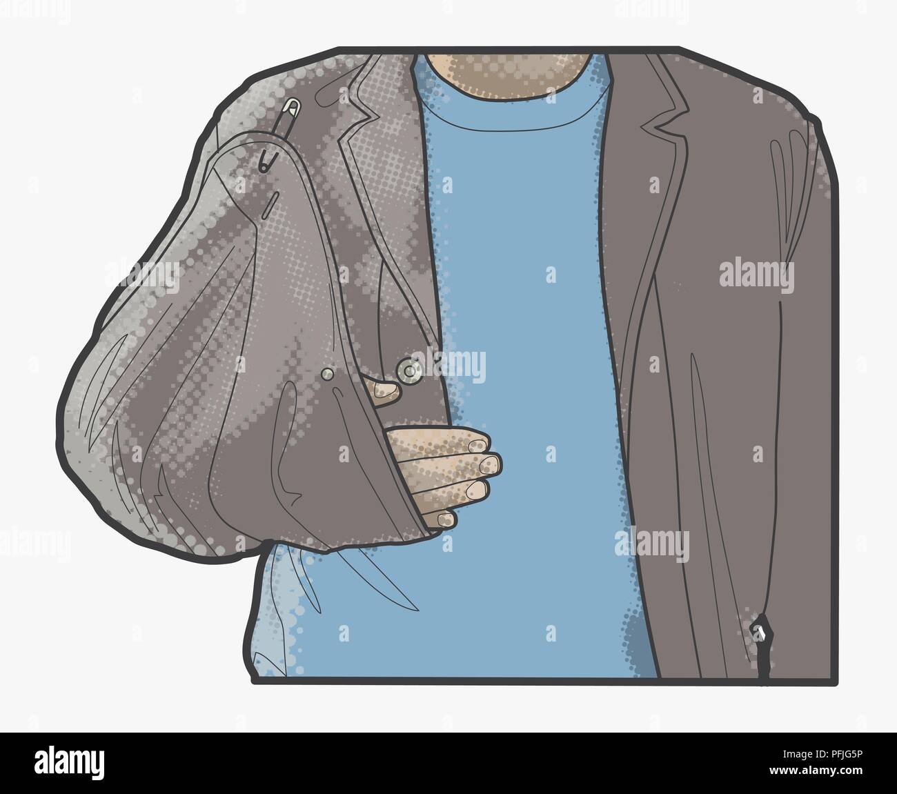 Digital illustration of man using jacket corner as sling Stock Photo ...