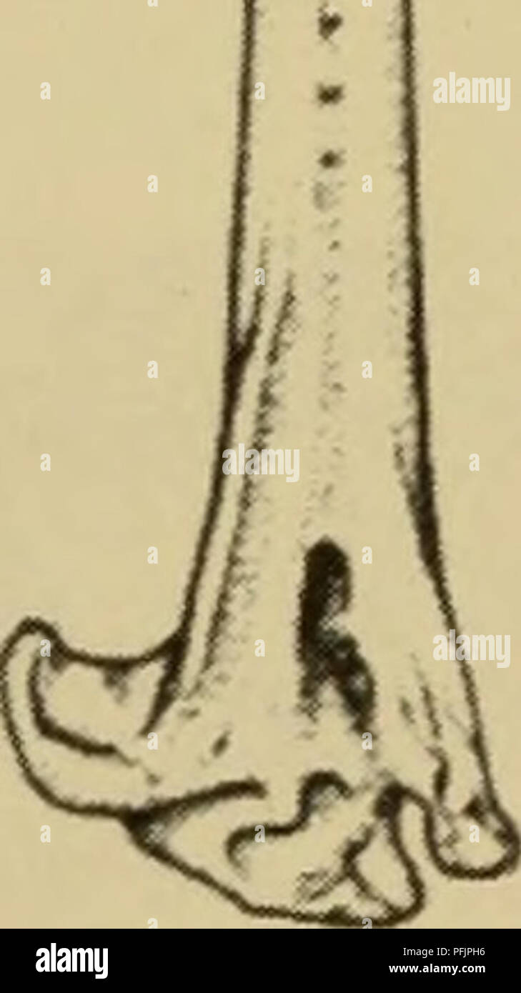 This image features the fin spines of the Mexican catfish (Galeichthys ...