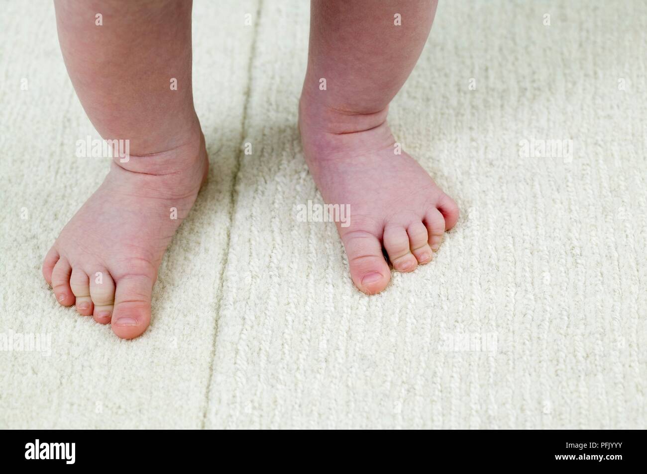 Baby Feet Standing Baby's Feet That Stood Up (1 Year And 2 Months...