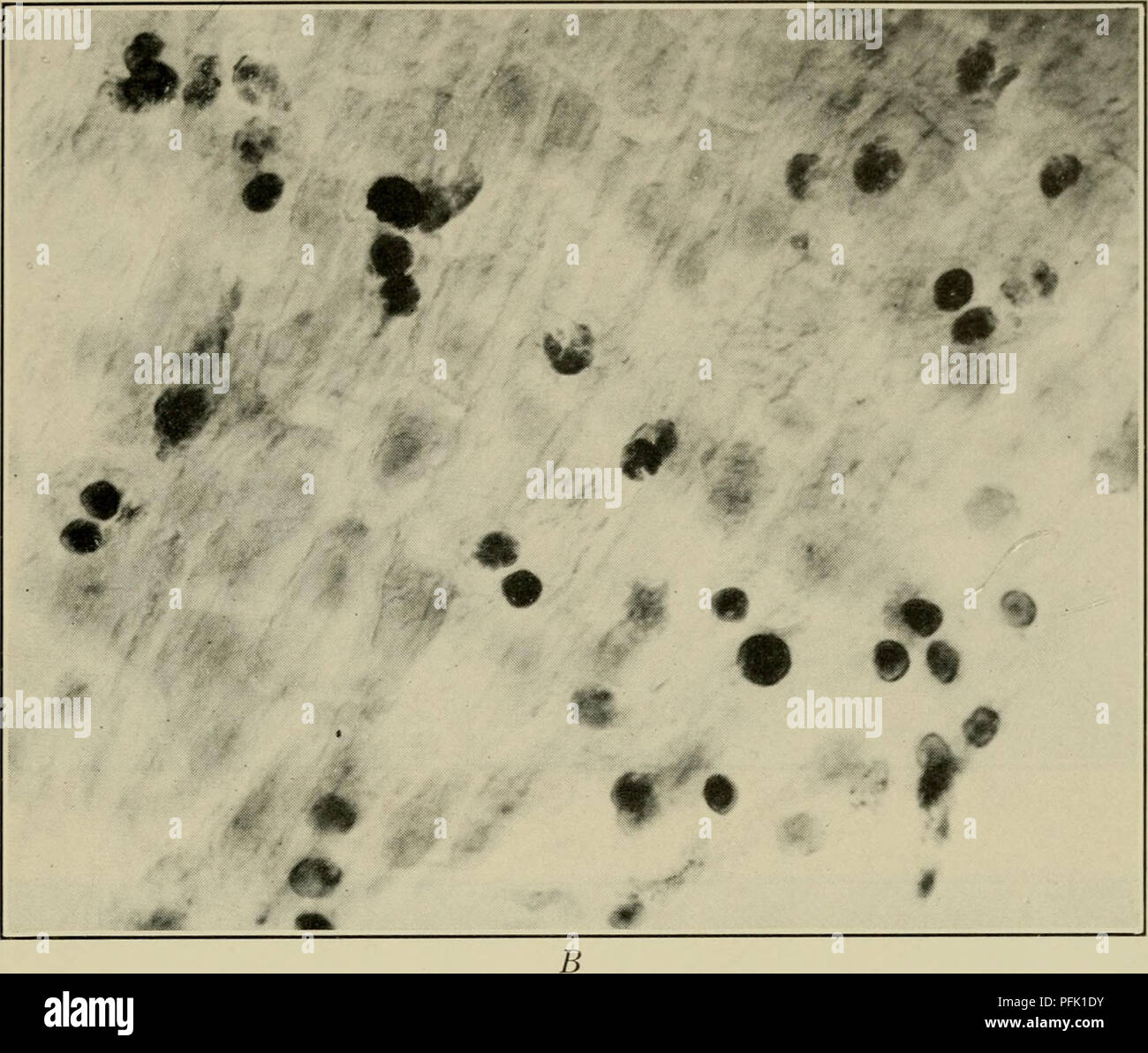 Onion root tips hi-res stock photography and images - Alamy