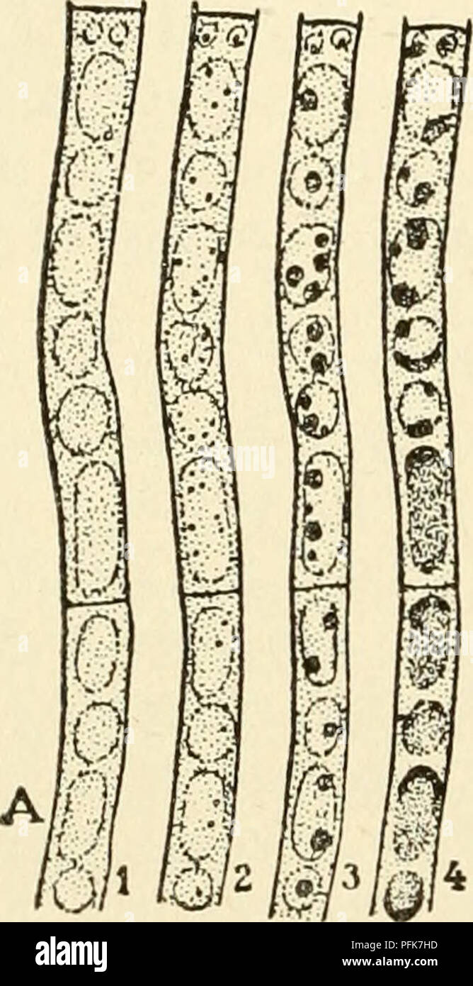 Plant Cell Leucoplast Tem
