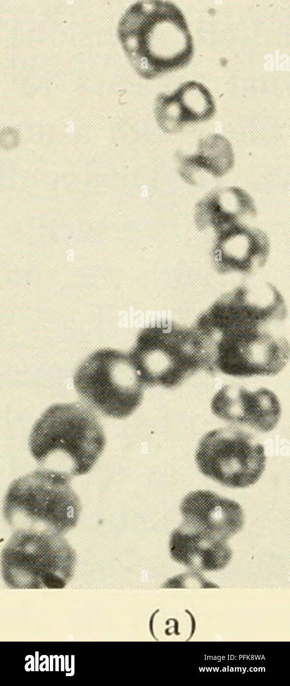 . Cytology. Cytology. (b) chromatin pattern character- istic of ...