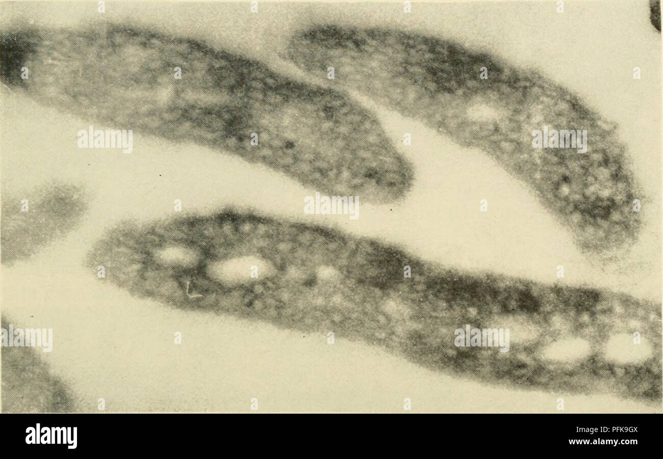 Plastids hi-res stock photography and images - Alamy