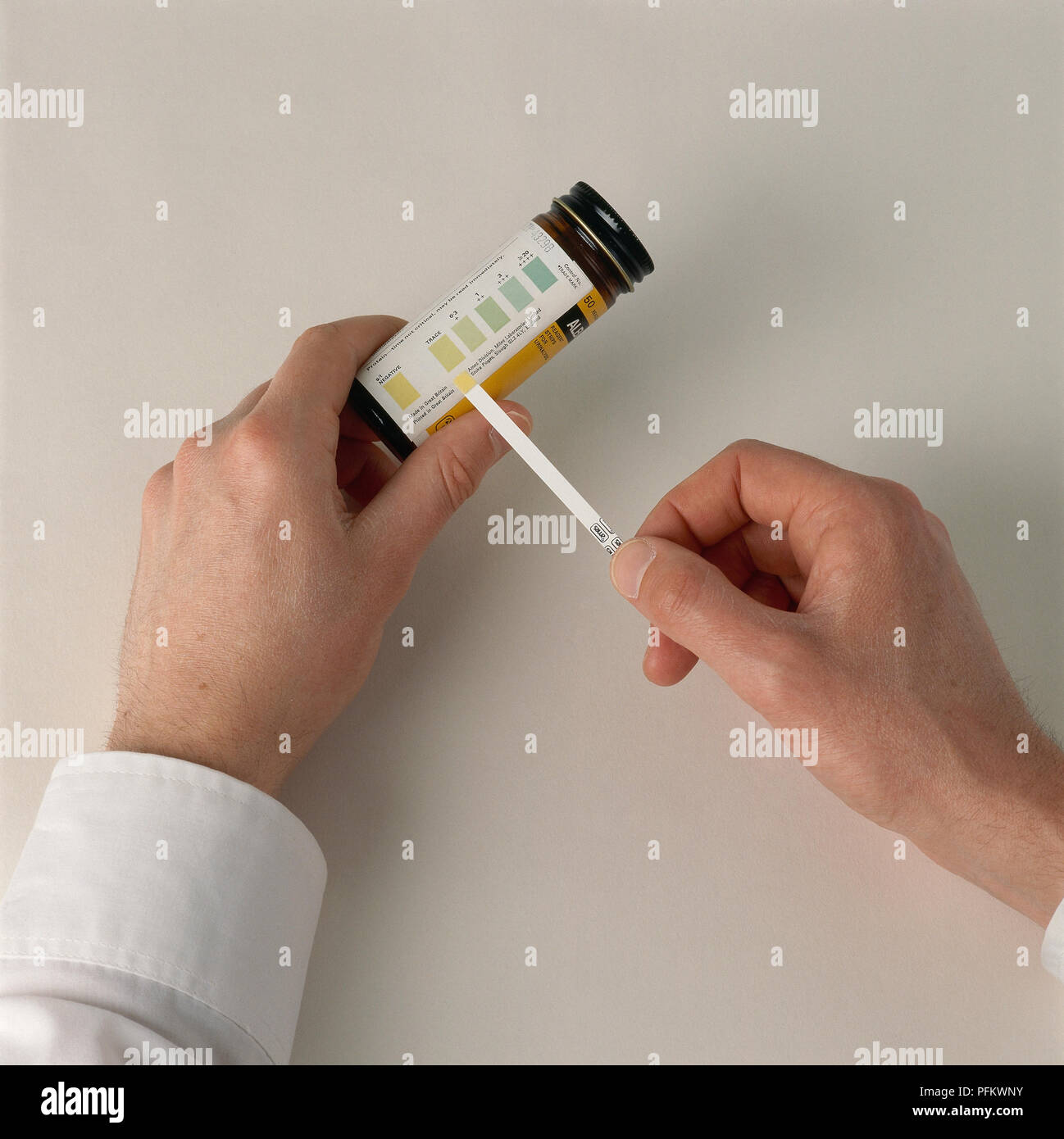 Comparing urine sample against printed chart Stock Photo - Alamy