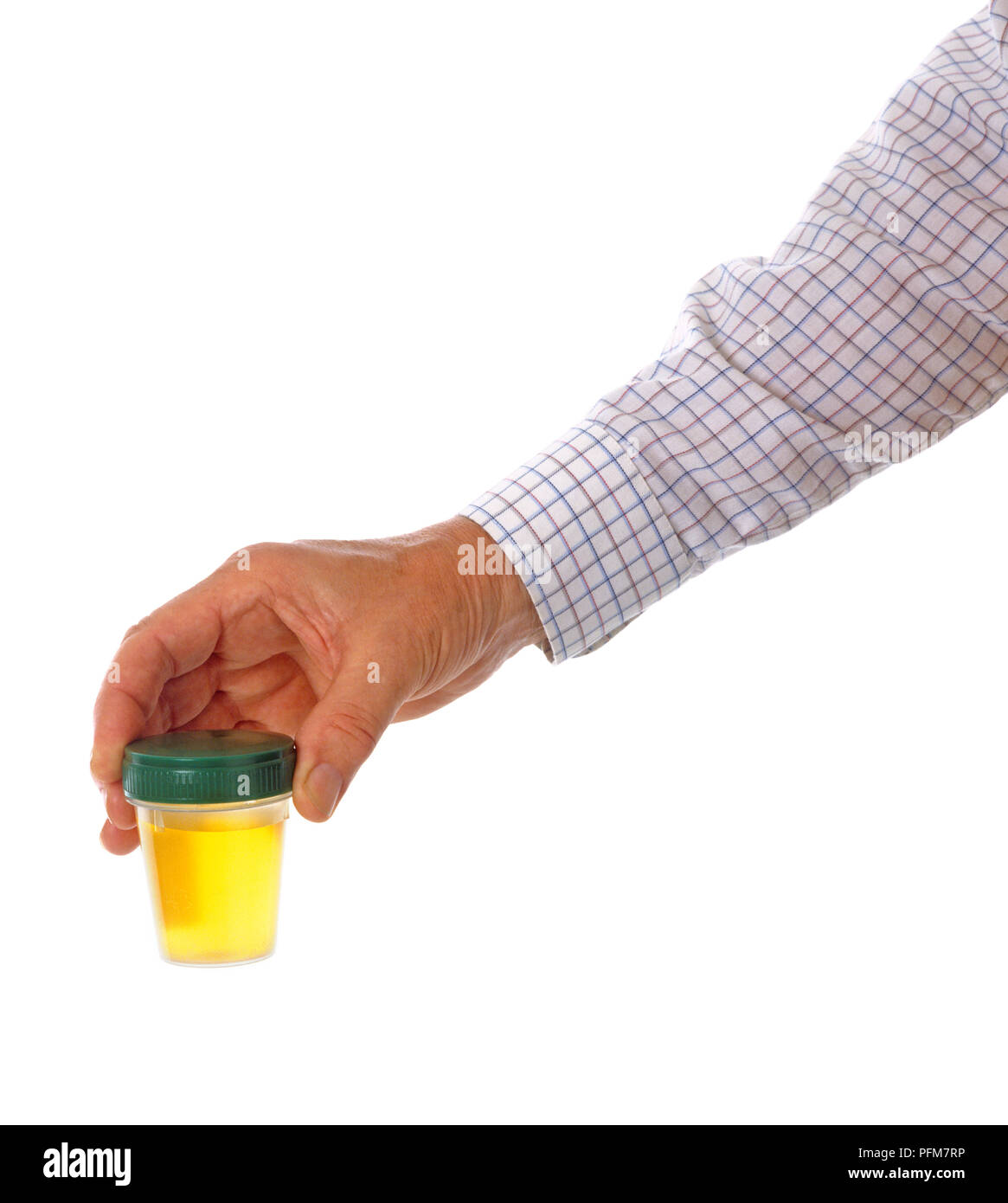 Man holding urine sample Stock Photo - Alamy