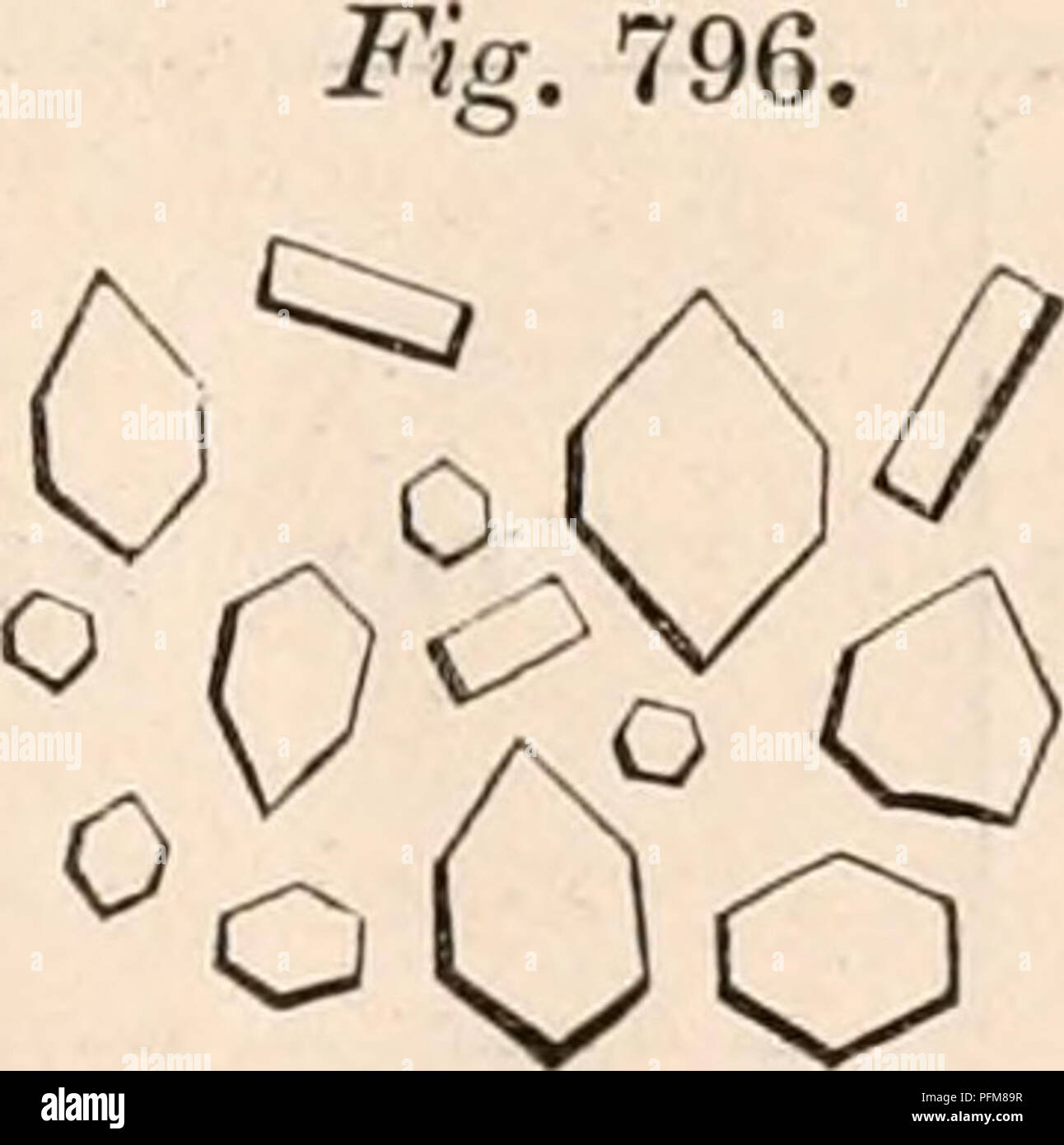 This entry discusses the formation of oxalate of lime crystals in urine ...