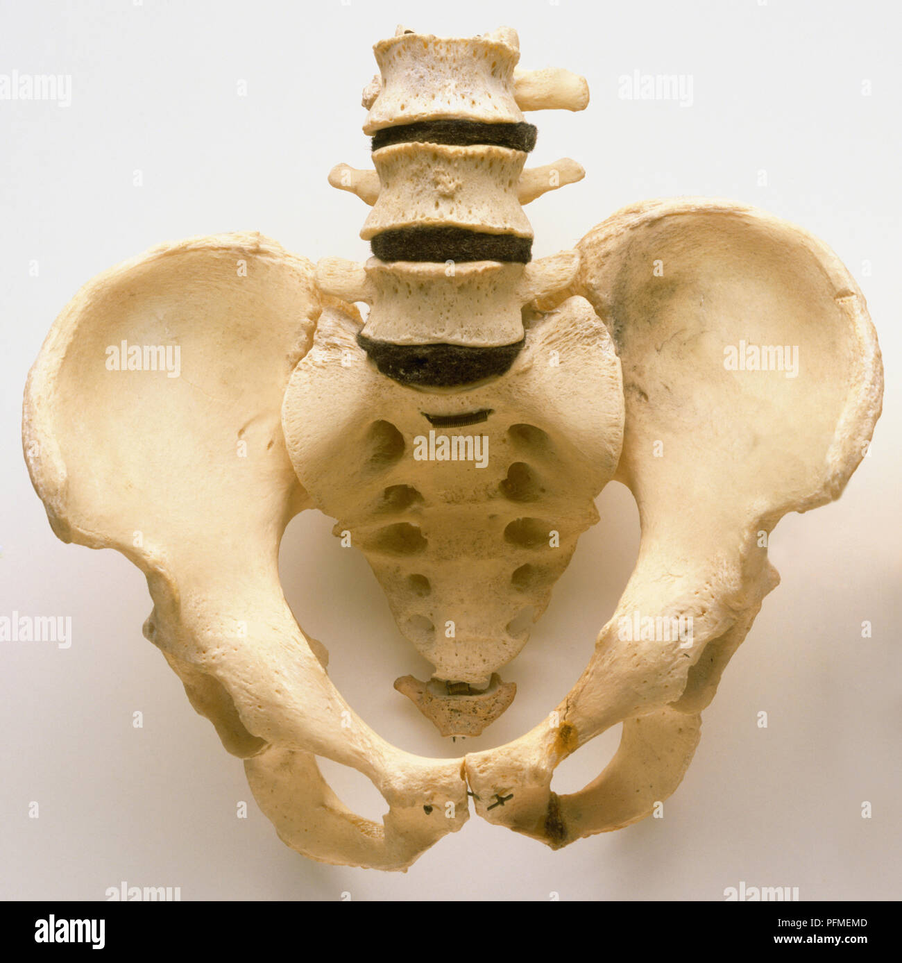 Acetabulum hi-res stock photography and images - Alamy