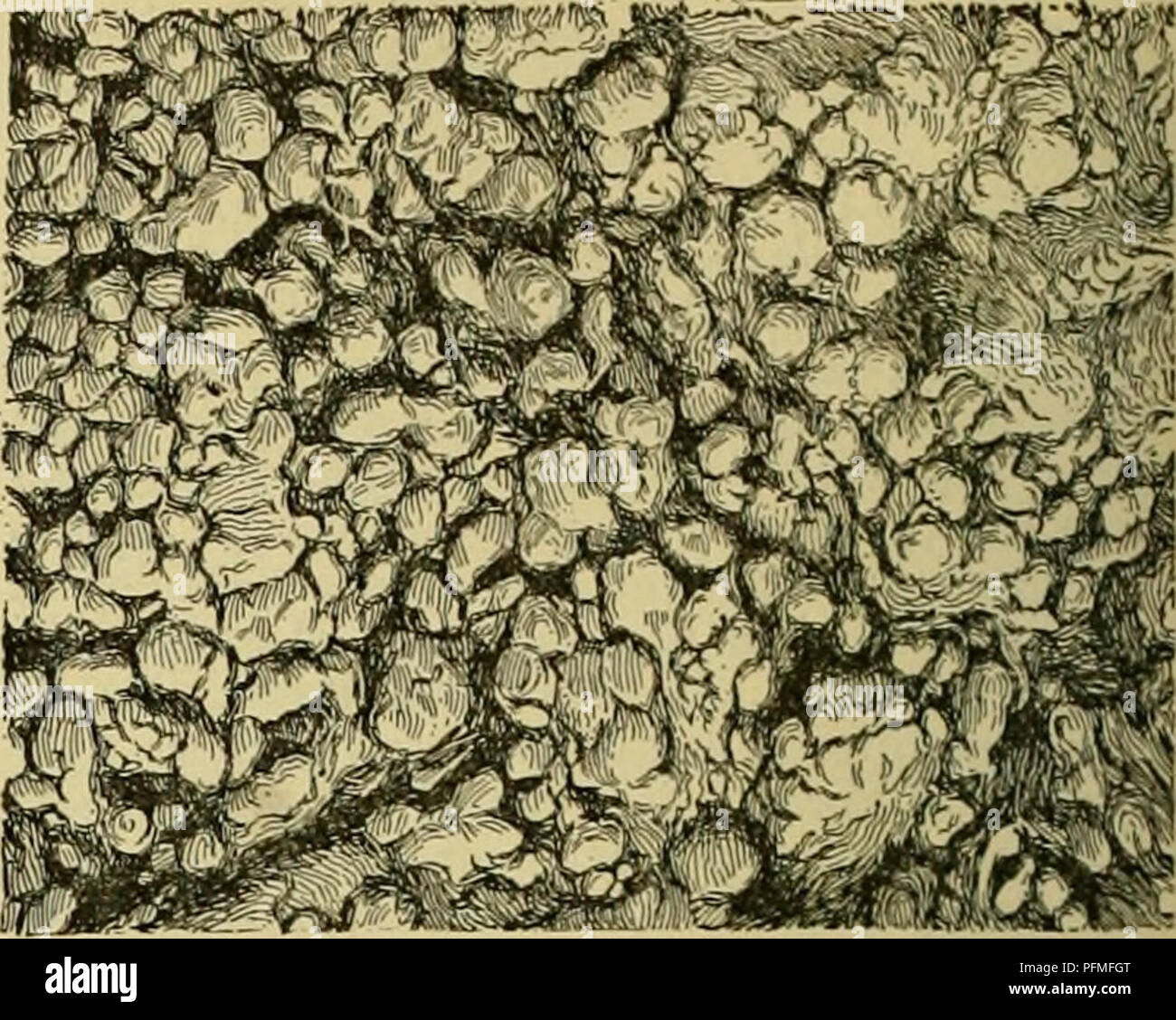 Bacilli tuberculosis hi-res stock photography and images - Alamy