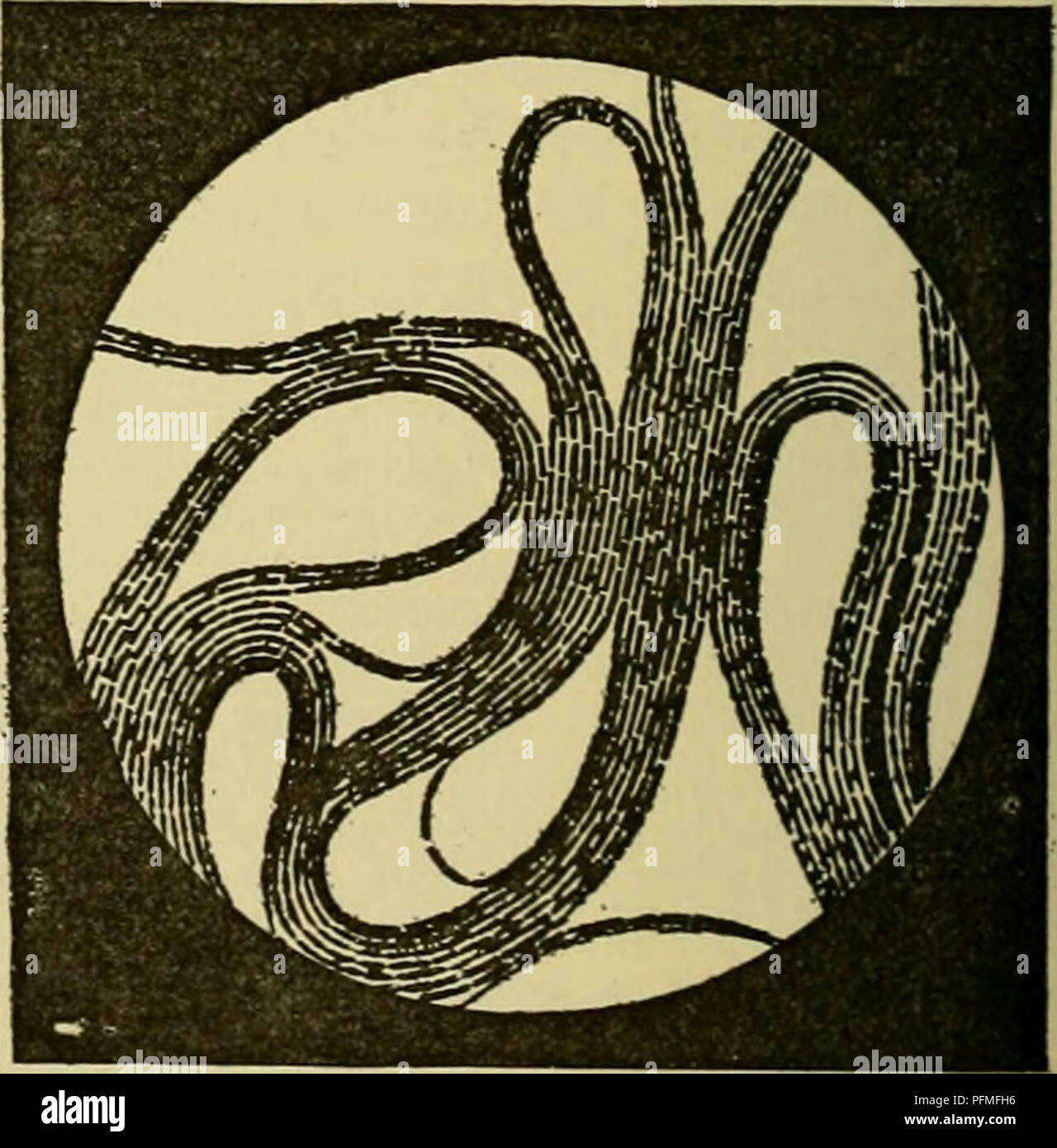 Peracute hi-res stock photography and images - Alamy