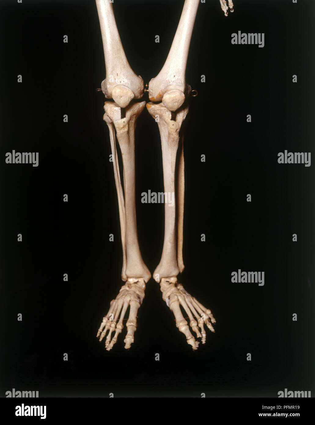 Real Leg Bones