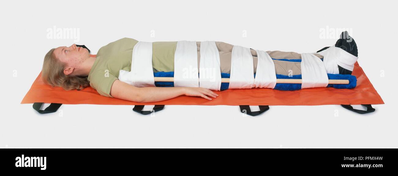 Woman strapped to a splint, lying on stretcher, side view Stock Photo ...