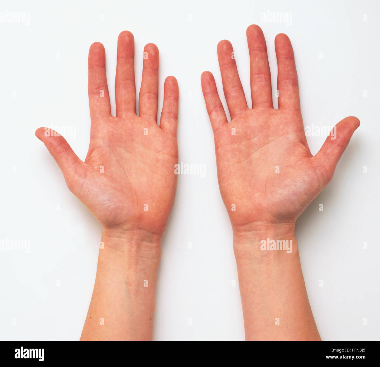 Open hand palm with finger apart Stock Photo - Alamy